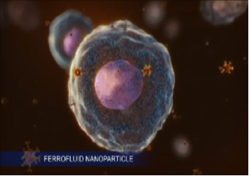 CELLSEARCH® | About CELLSEARCH® | How the CELLSEARCH® CTC Test Works?