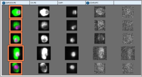 CELLSEARCH® | About CELLSEARCH® | How the CELLSEARCH® CTC Test Works?